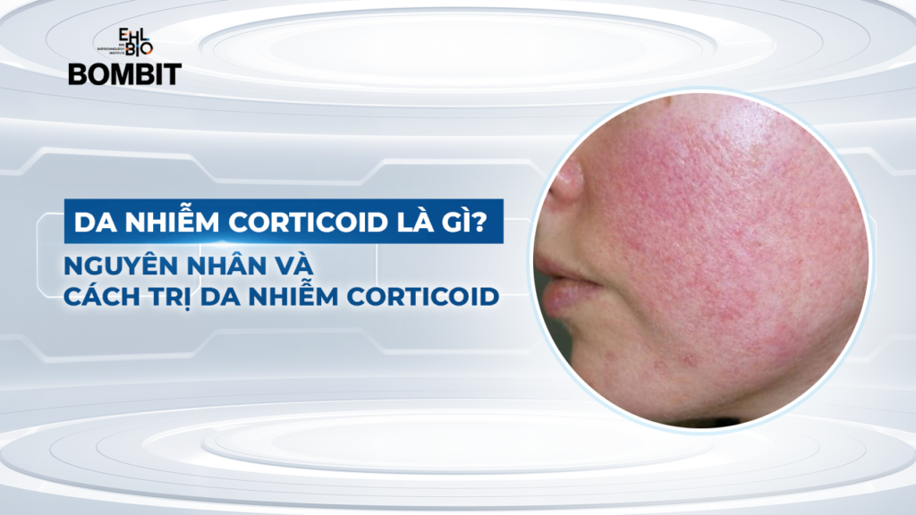 Da nhiễm corticoid là gì? Nguyên nhân và cách trị da nhiễm corticoid